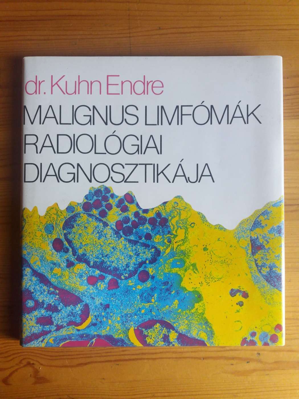 dr. Kuhn Endre: Malignus Limfómák radiológiai diagnosztikája RITKA ...